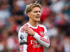 Mikel Arteta provides Martin Odegaard injury update and discusses William Saliba Arsenal ...